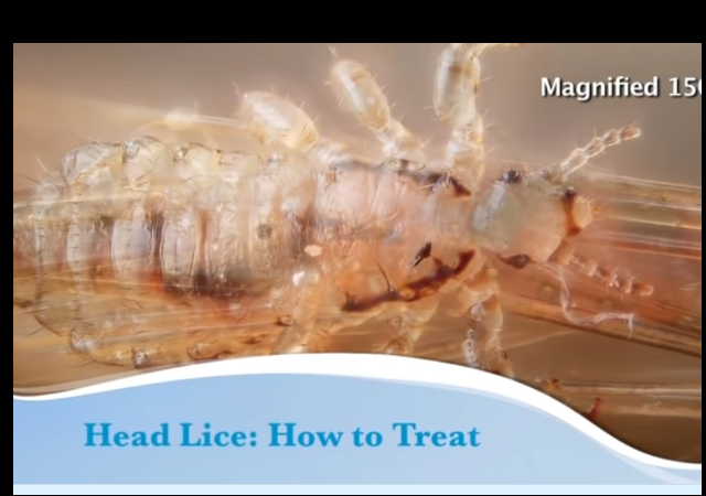 American Academy of Pediatrics: Don’t Send Home Kids with Head Lice to ...